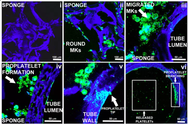 El model de medul·la òssia 3D fet de Biosilk genera plaquetes de sang 15998_2