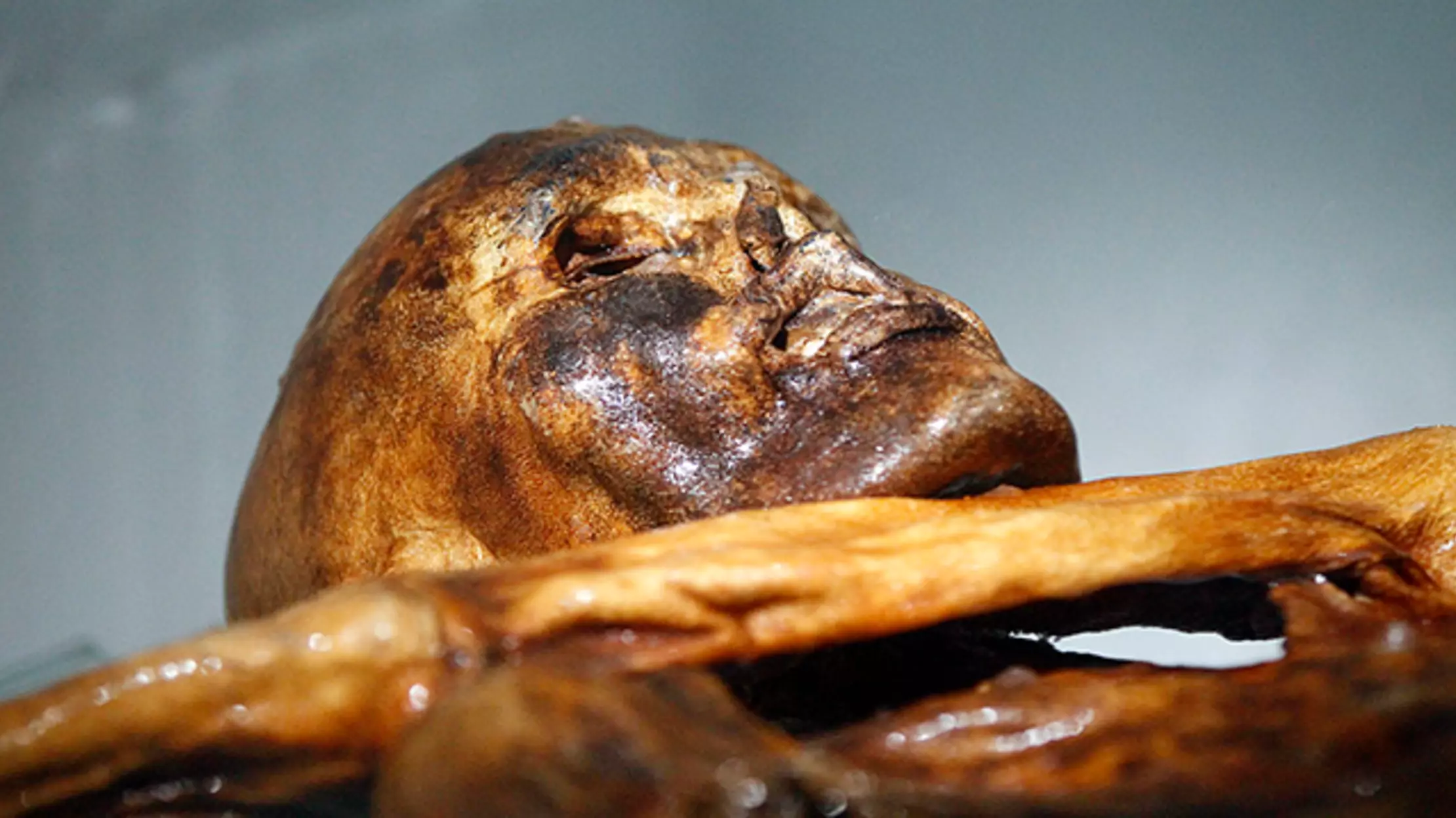 Ötzi the Iceman Mae'n debyg ei fod yn caru cig moch hefyd