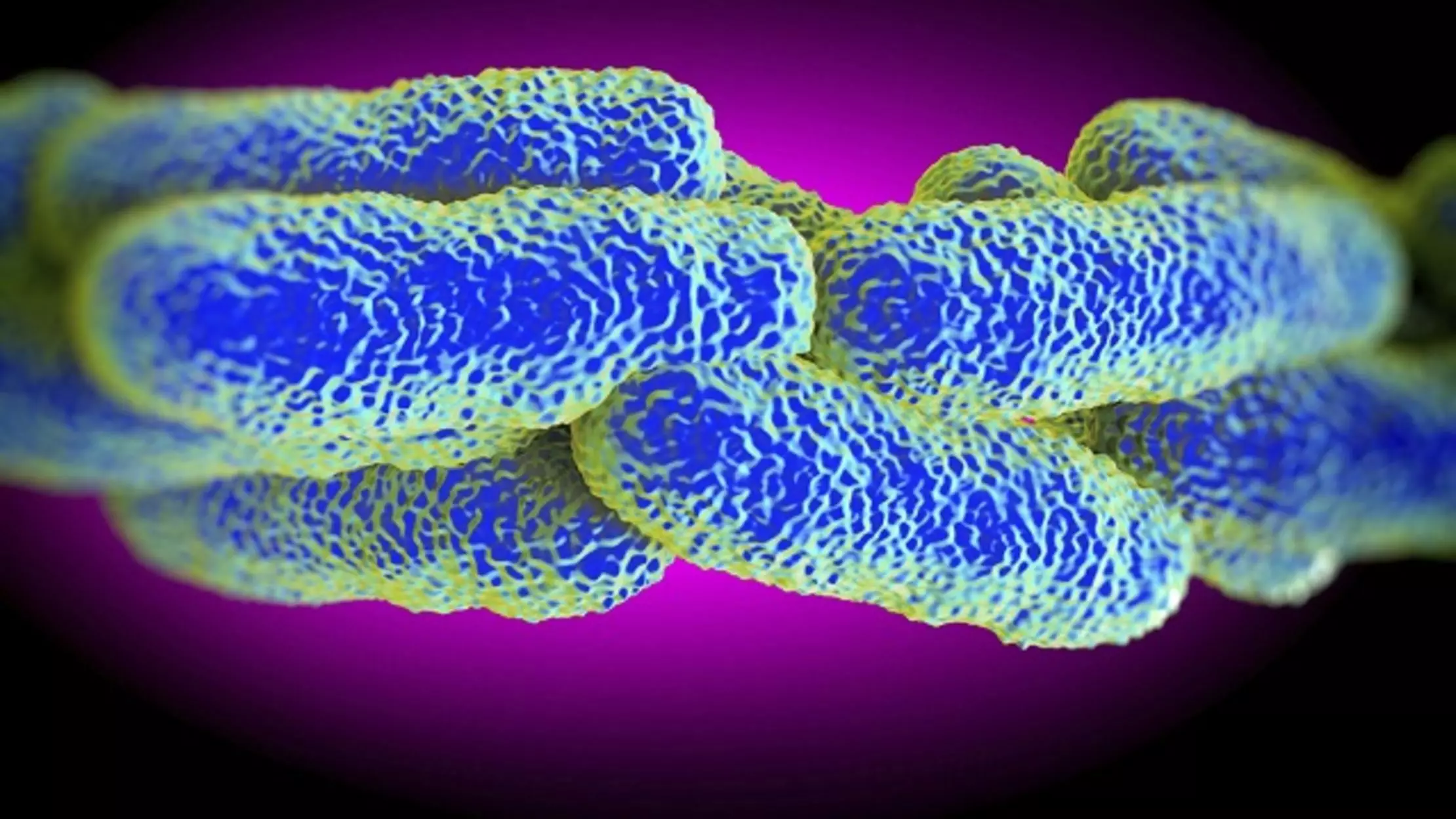 Què és la malaltia dels legionaris?