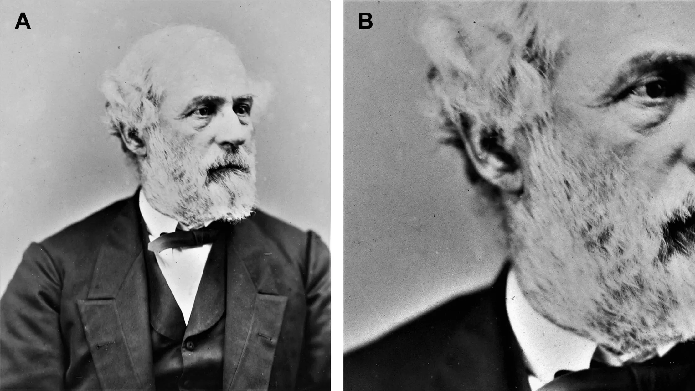 De sleutel tot de raadselachtige dood van Robert E. Lee is mogelijk verborgen in een foto van zijn oorlel